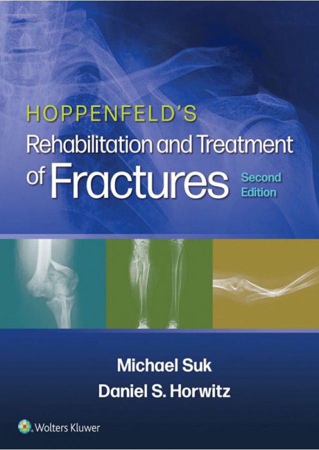 Hoppenfeld’s Treatment and Rehabilitation of Fractures E-book