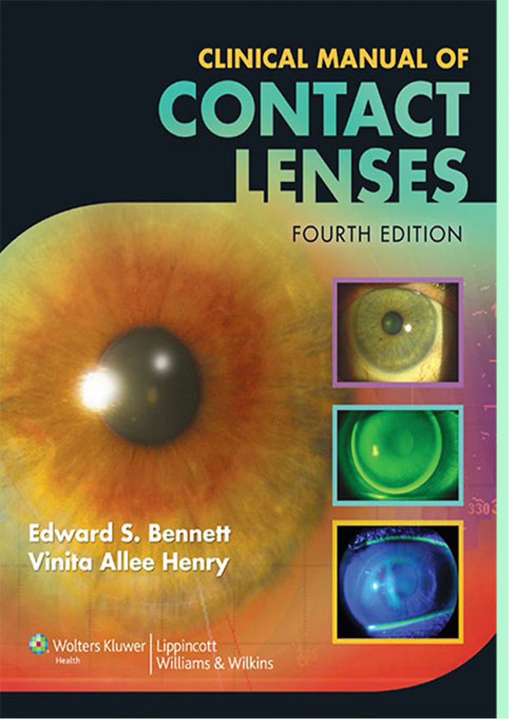 Clinical Manual of Contact Lenses