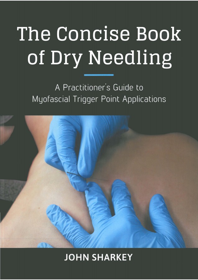 The Concise Book of Dry Needling